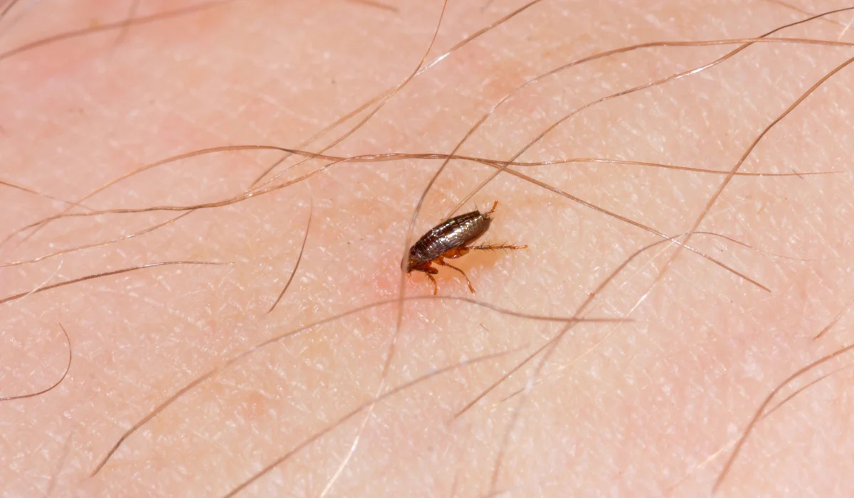 Are Those Flea Bites? Here’s How to Tell